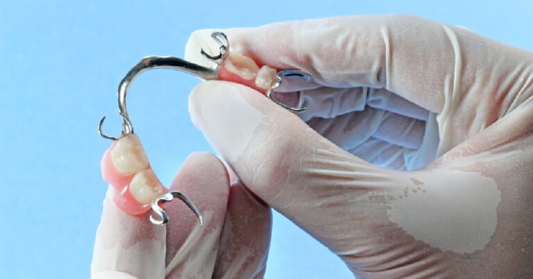 Do Partial Dentures cost less than Traditional Dentures? | Jefferson Lee Clark